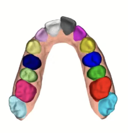 Semi-supervised segmentation of tooth from 3D scanned dental arches ...